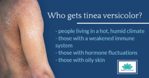 What are these spots on my skin? Tinea Versicolor Explained - SJH Derm