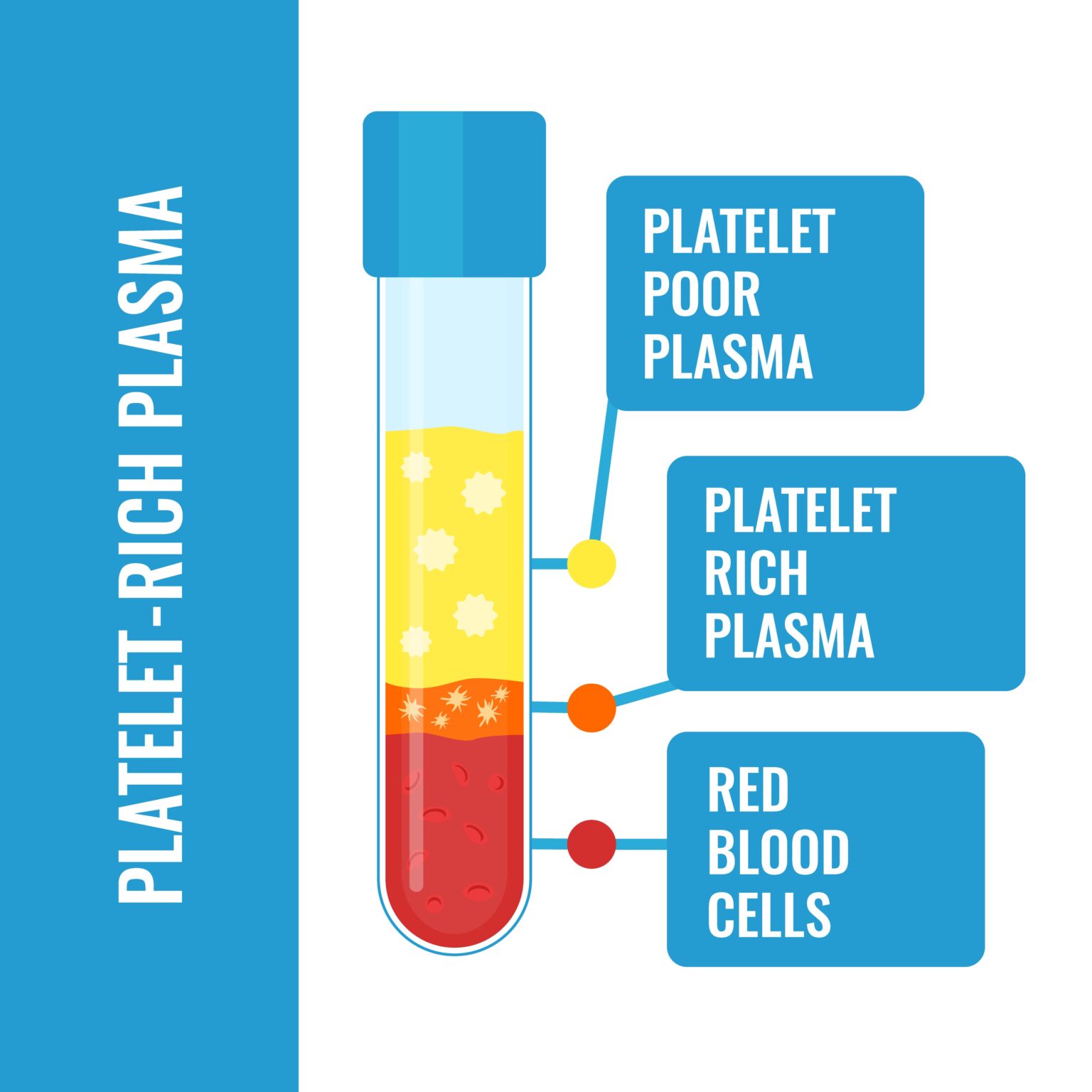 PRP Injections vs. Dermal Fillers - SJH Derm